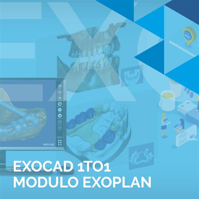 Exocad 1to1 MODULO EXOPLAN - Accademia Archimede - Formazione nel ...